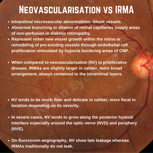 Neovascularisation vs IRMA — Ophthalmobytes
