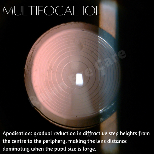 Types of Multifocal IOL — Ophthalmobytes