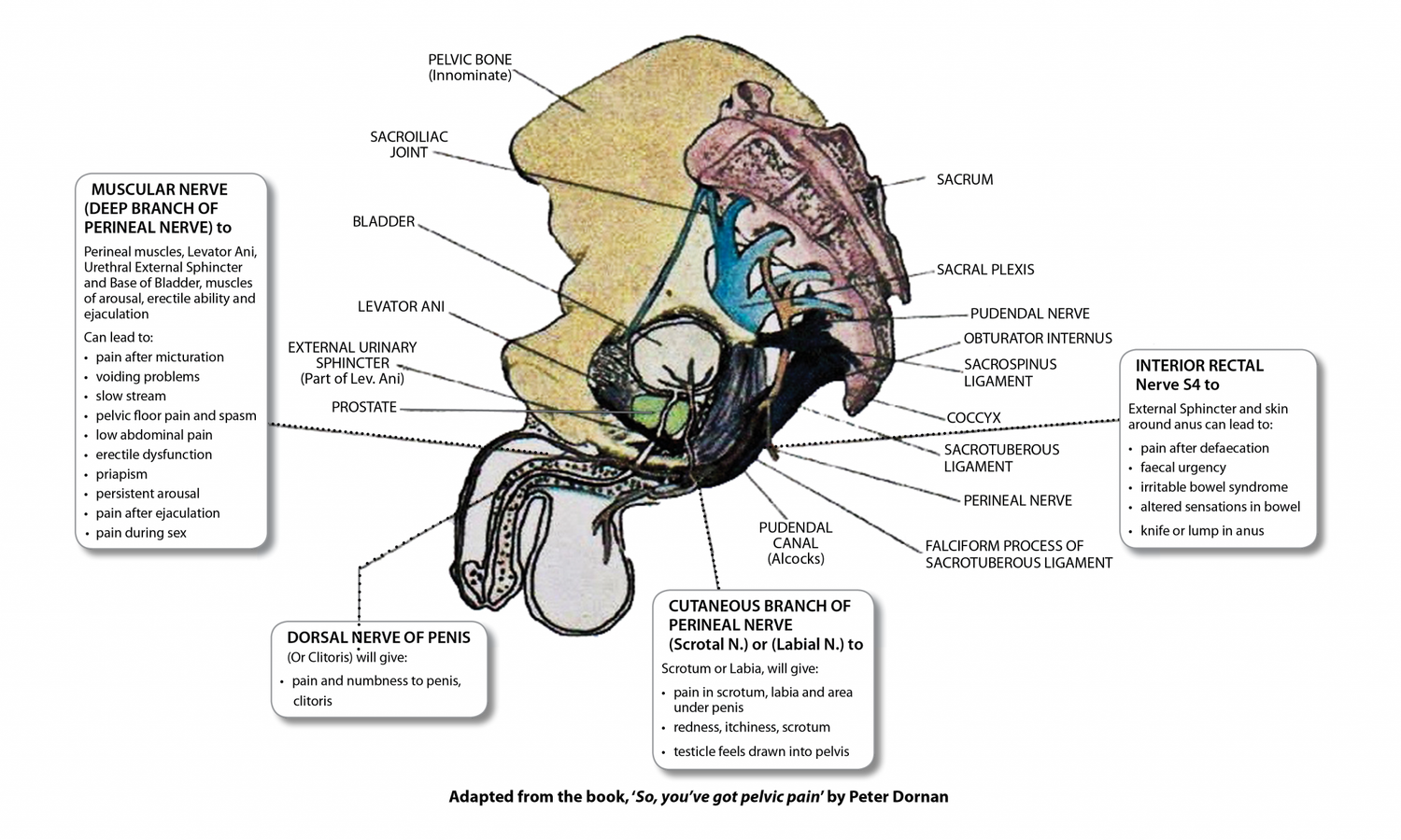 Pudendal Neuralgia — Pelvic Pain Foundation of Australia