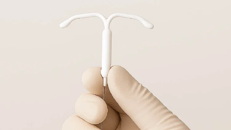 What Is the Contraception Scheme in Ireland - Contraception Club