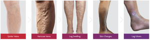 Vascular Surgeons of Southern Delaware