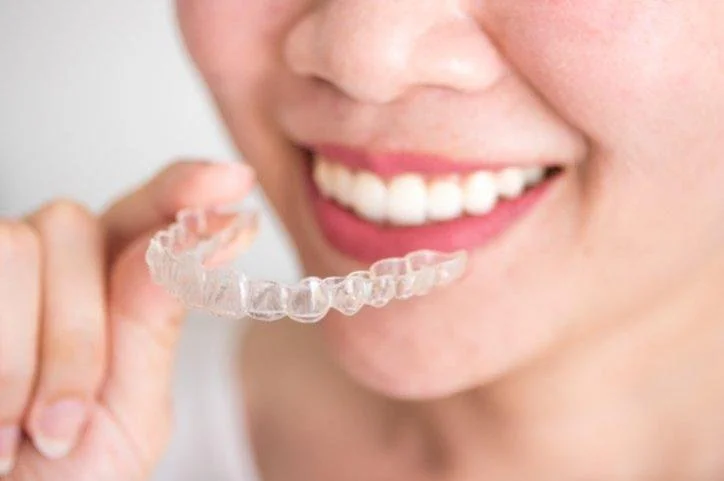 How Long Do Retainers Last? When To Get A Replacement Retainer ...