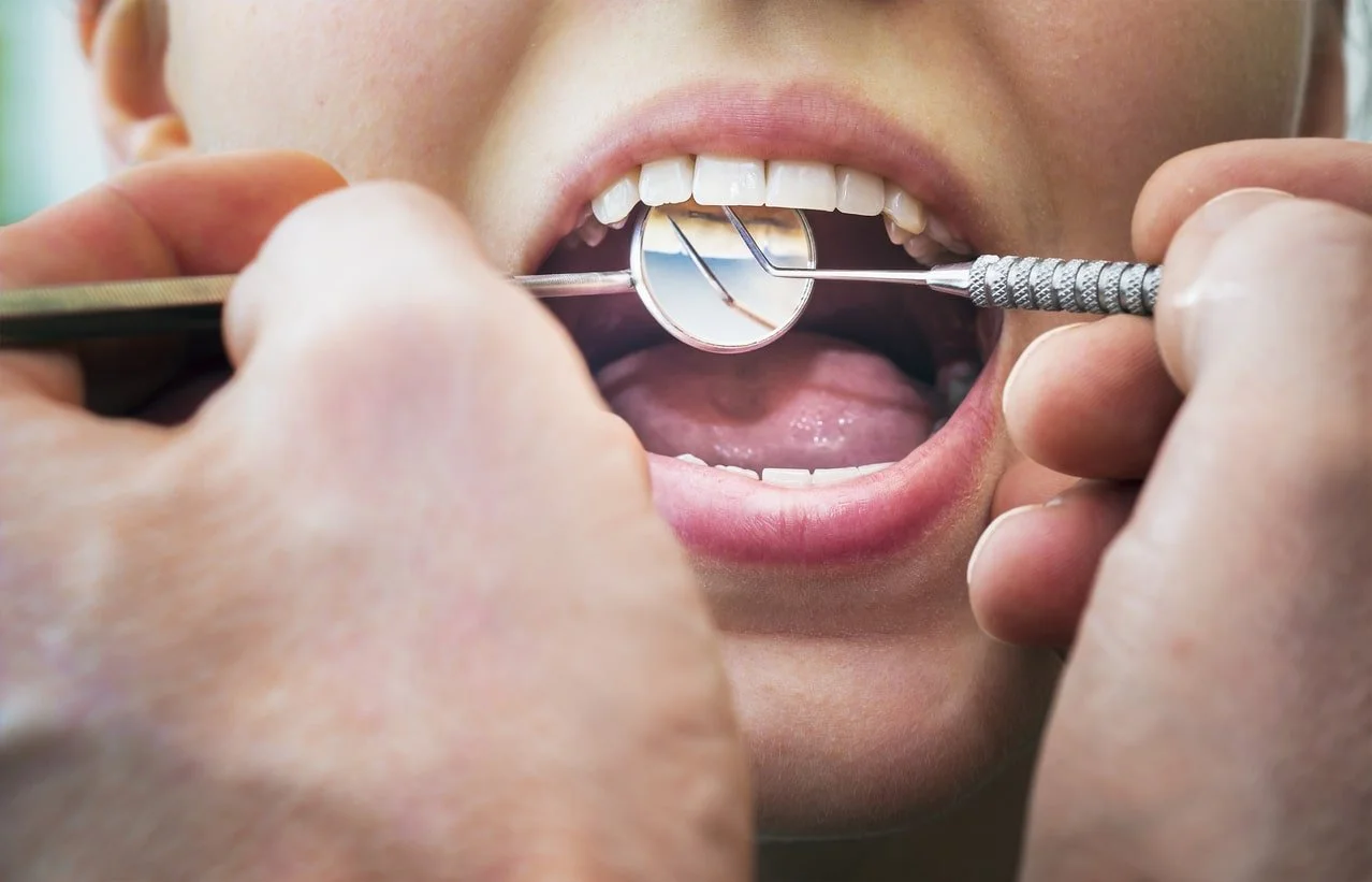 Keeping Your Smile Straight: Your Guide to Bonded Retainers ...