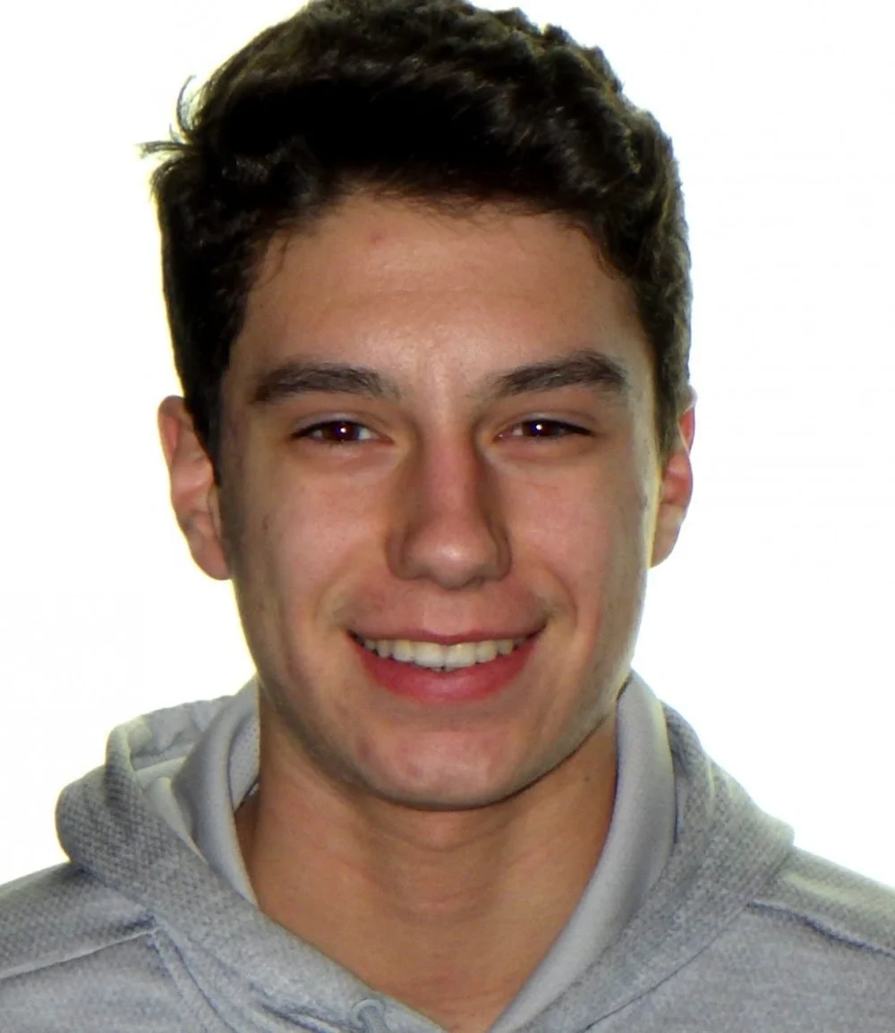 Benefits of Using a Herbst Appliance — Orthodontic Arts