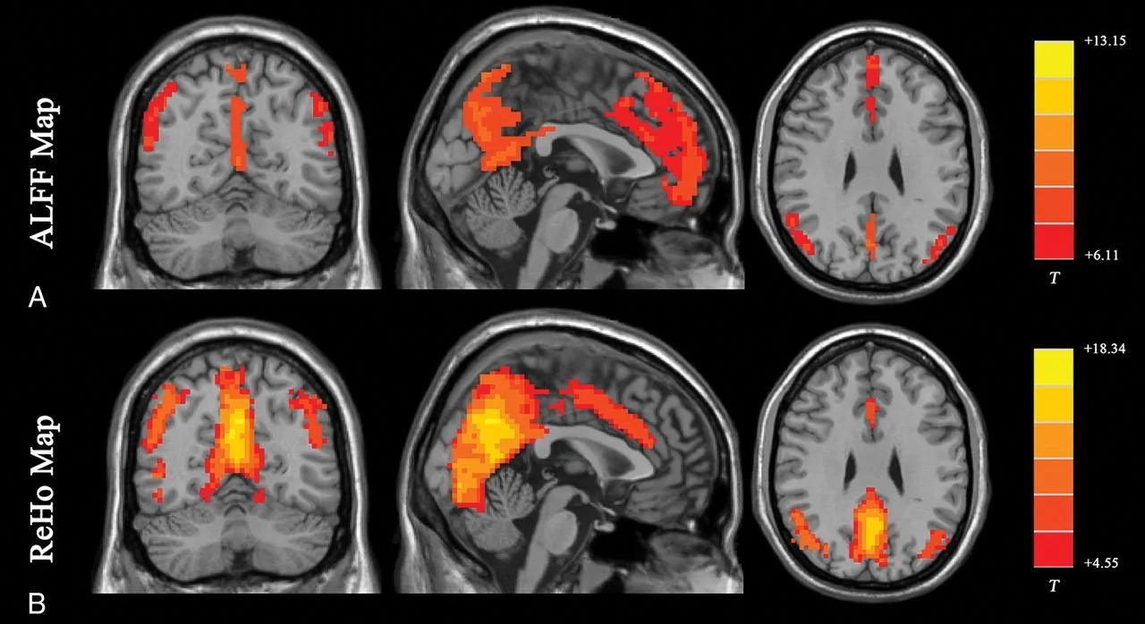 fMRI Resources — American Society of Functional Neuroradiology