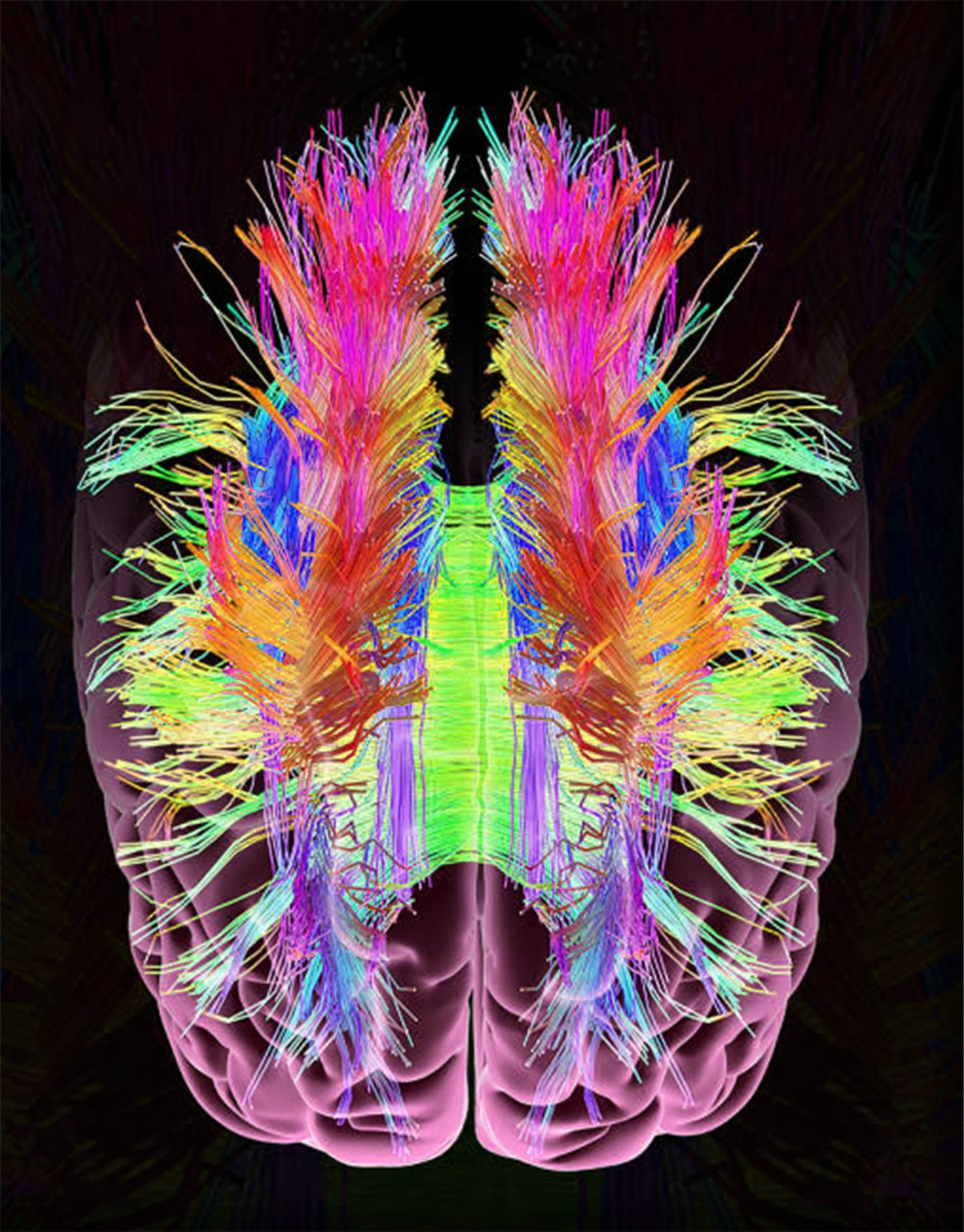 What is Diffusion Imaging? — American Society of Functional Neuroradiology