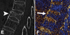 What is Dual Energy CT? — American Society of Functional Neuroradiology