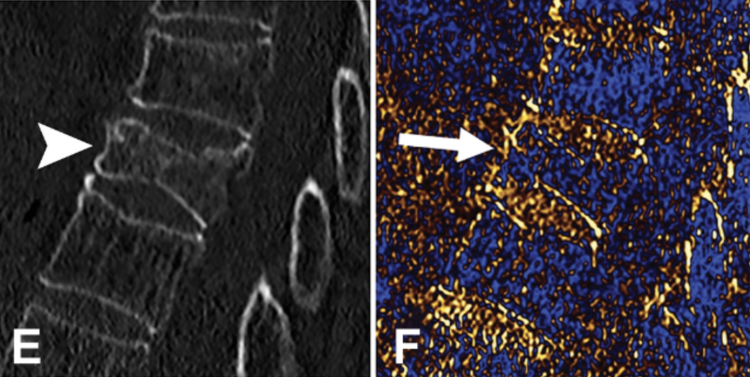 What is Dual Energy CT? — American Society of Functional Neuroradiology