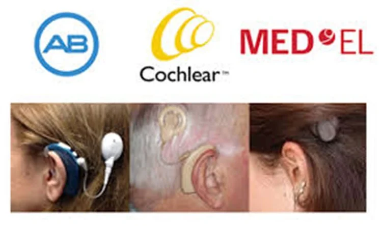 How to Choose the Right Cochlear Implant Brand: A Complete Guide for ...