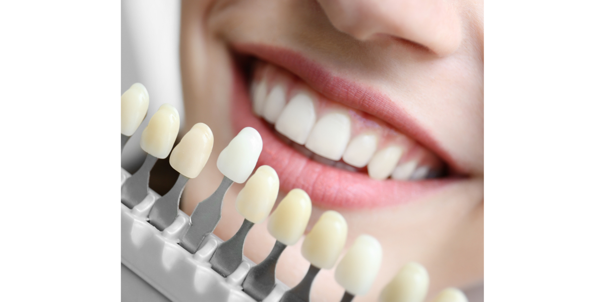 Teeth Whitening | Enhance Your Smile Today — Book Now — Sculpt Body ...
