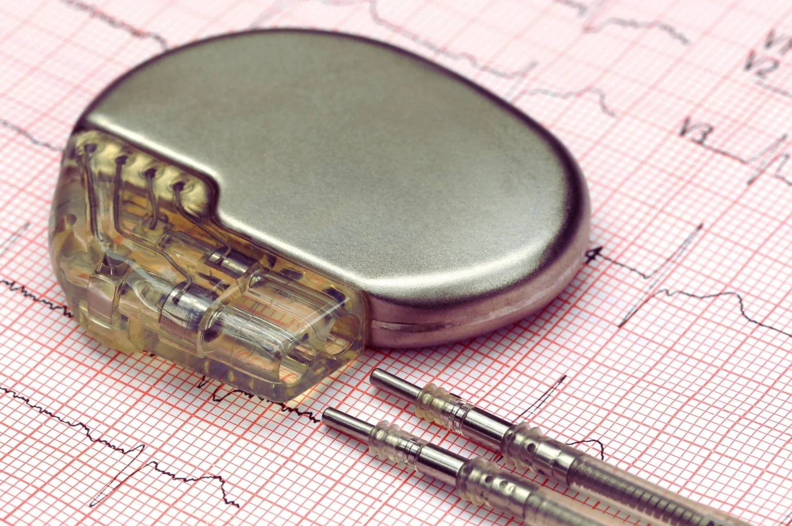 Pacemaker & Defibrillator Monitoring in Kaneohe, Honolulu, Wailuku ...