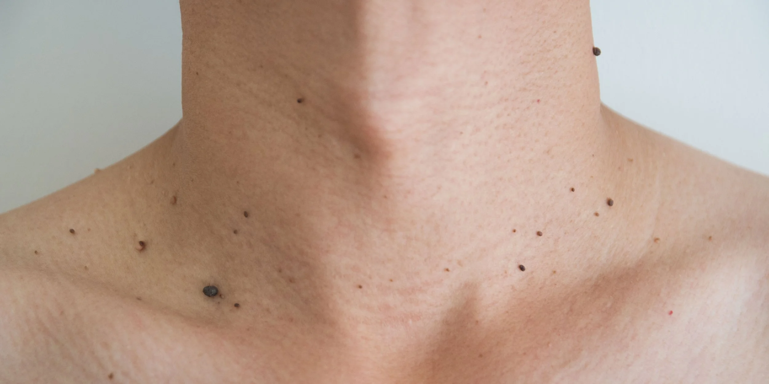 Minimally Invasive Skin therapies