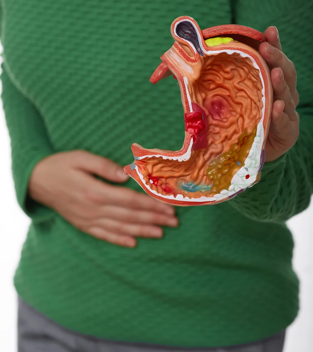 Blood in Stool or Toilet Paper — Sanjiv Sood M.D Gastroenterology