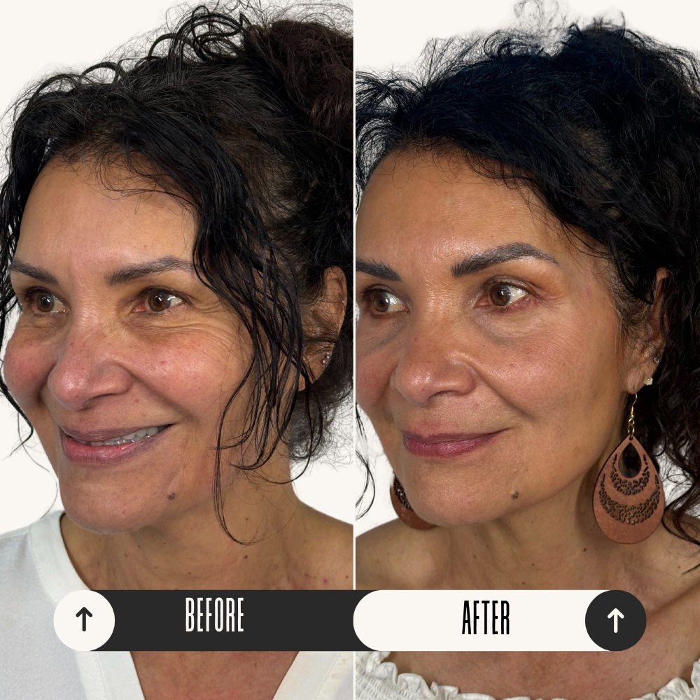 Reviews 1 — Anova Med Spa