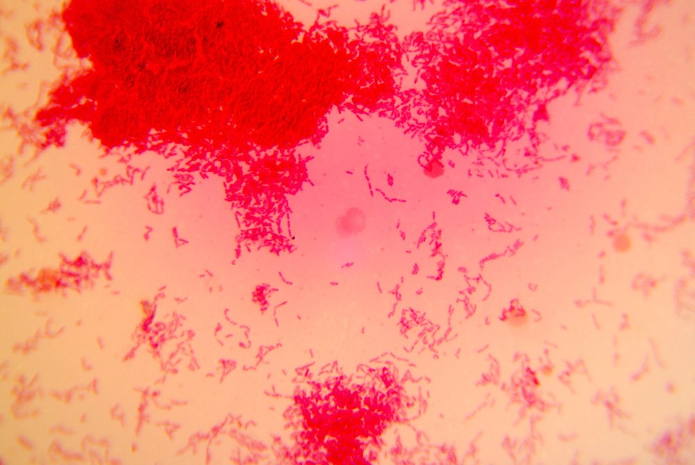 Bacterium is Beautiful: Microbial Art & Science by BioPathogenix