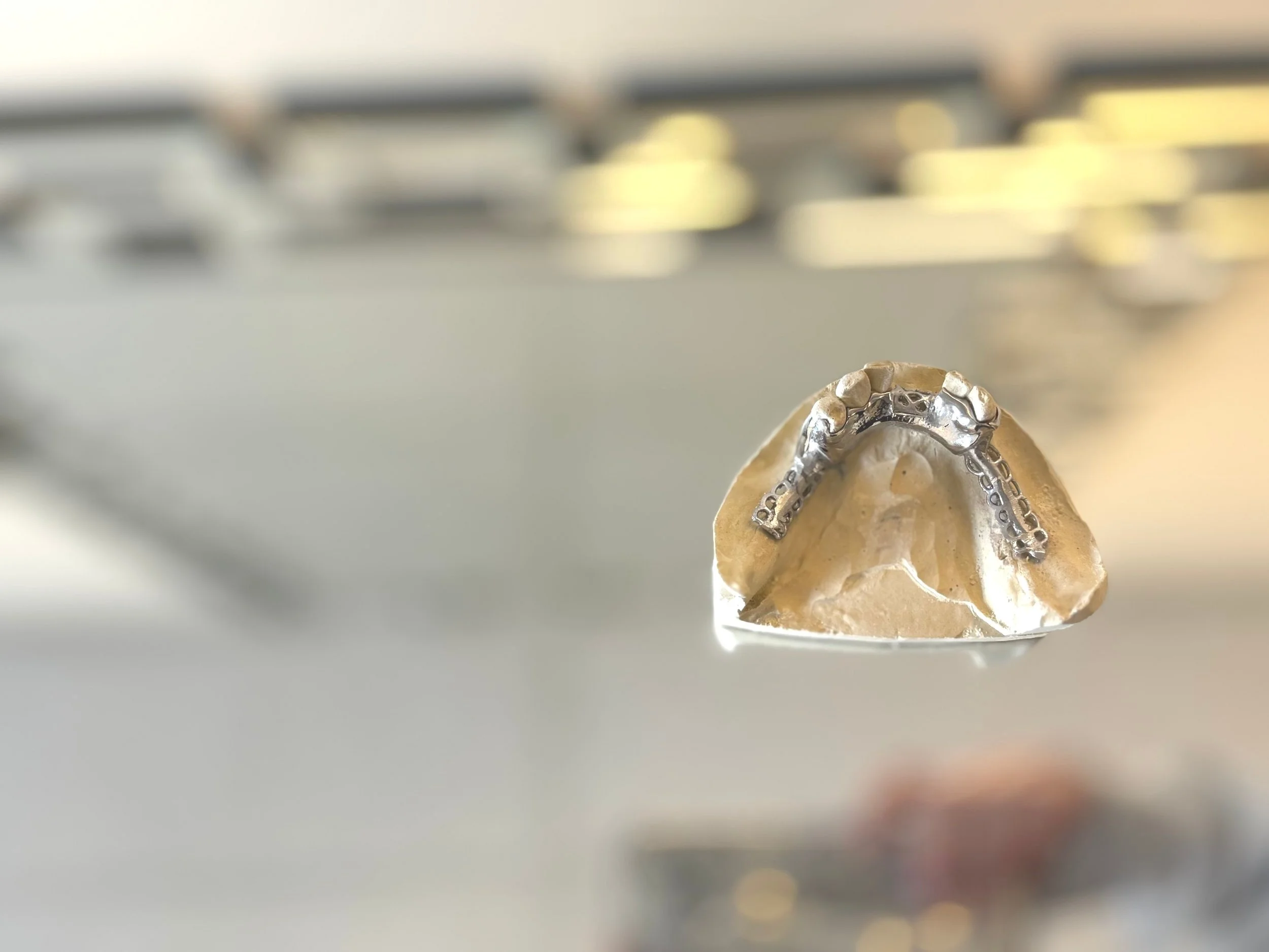 Cast Partials | 50% OFF your first order — Denture Crafters