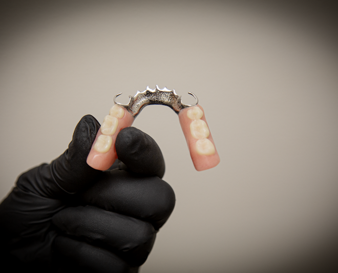 Acrylic Partials | Affordable and Customizable — Denture Crafters