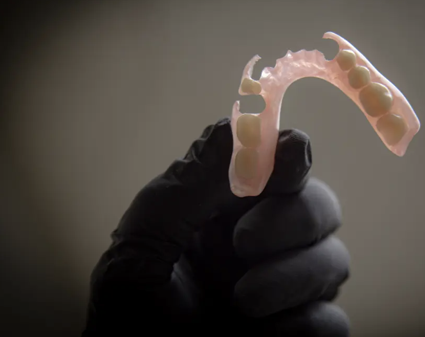 Acrylic Partials | Affordable and Customizable — Denture Crafters