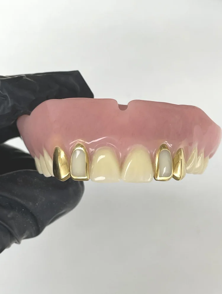 Custom Gold Teeth | 50% OFF first order — Denture Crafters
