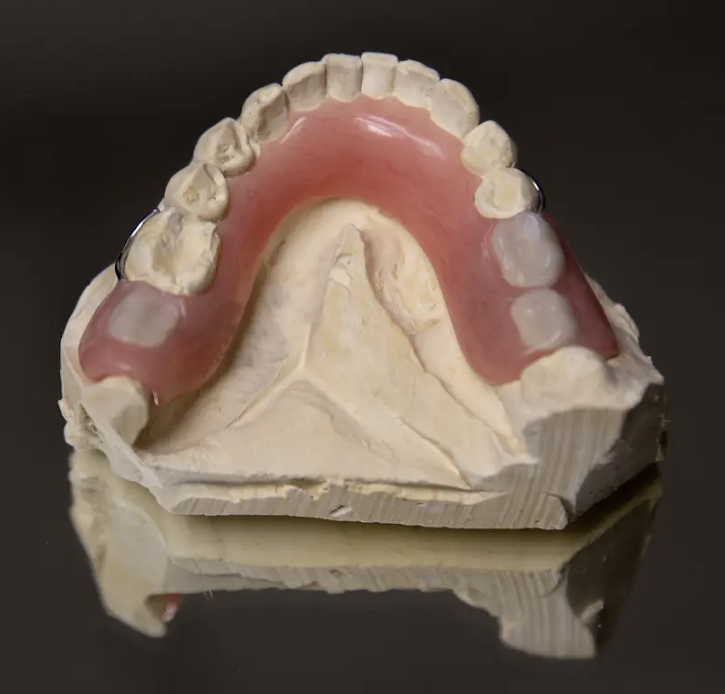 Acrylic Partials | Affordable and Customizable — Denture Crafters