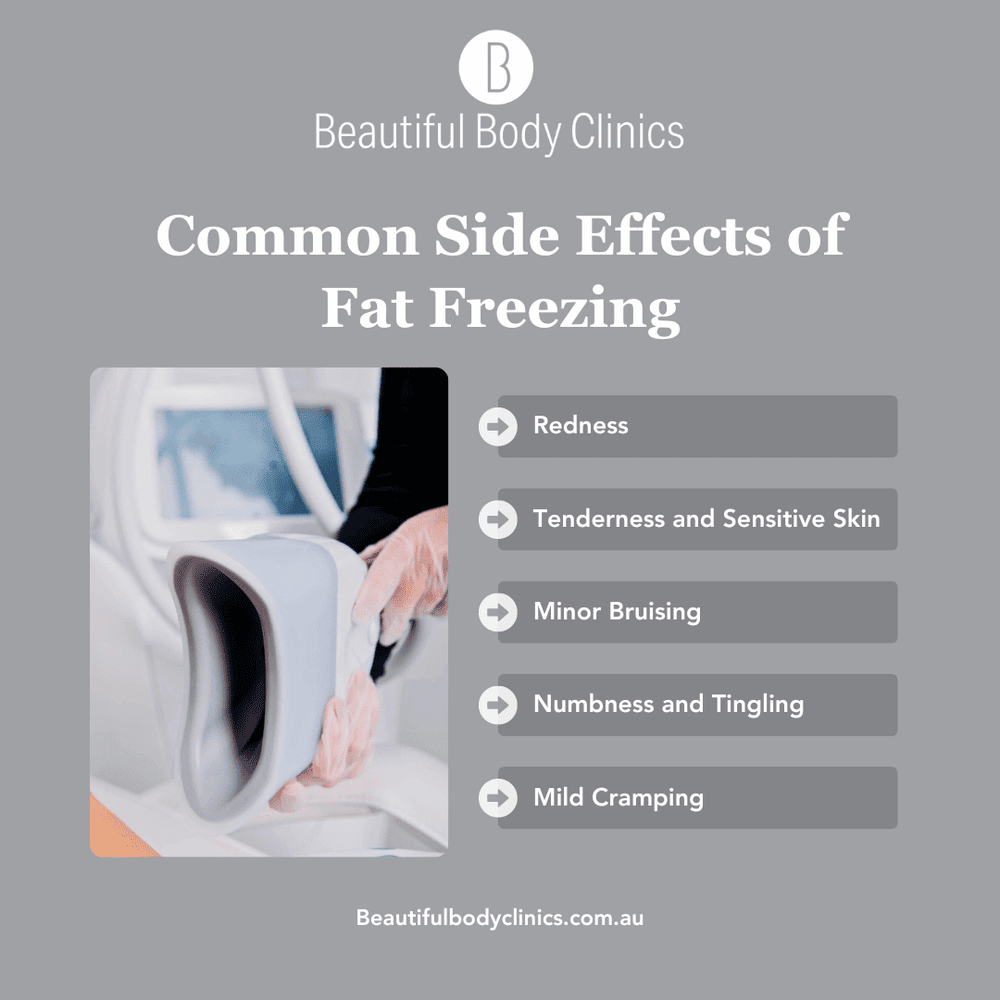Navigating the Chill: Understanding Fat Freezing side effects