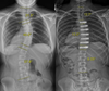 Robert H. Cho, MD, FAAOS, FAOA | Schedule Expert Pediatric Spine Care