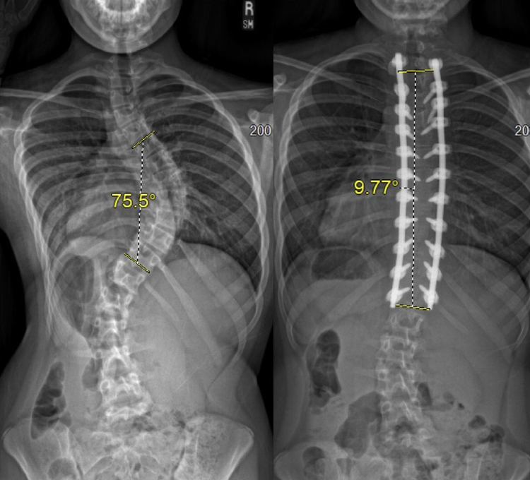 Robert H. Cho, MD, FAAOS, FAOA | Schedule Expert Pediatric Spine Care