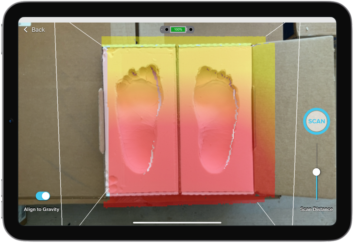 Scanning | Enhance Orthotics Today - Discover Advanced Scanning — Biostep