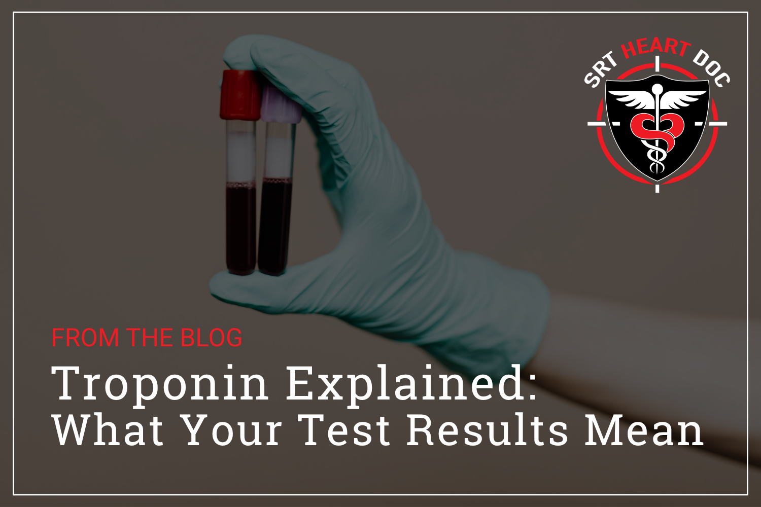 Troponin Explained: What Your Test Results Mean — SRT Heart Doc