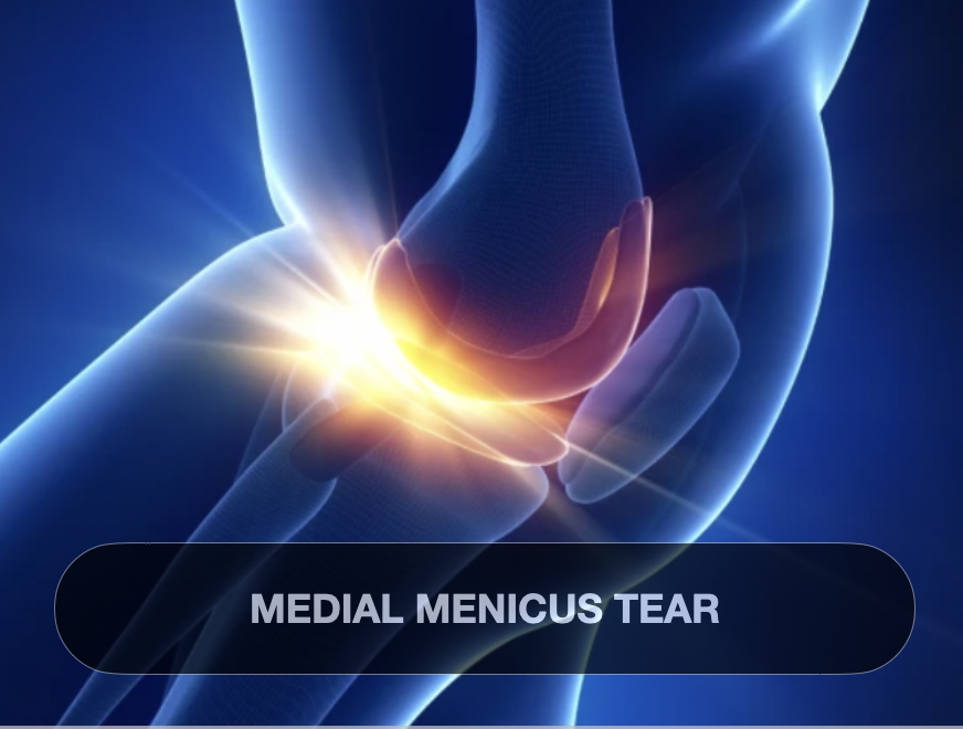 About 5 — Lower Extremity Group