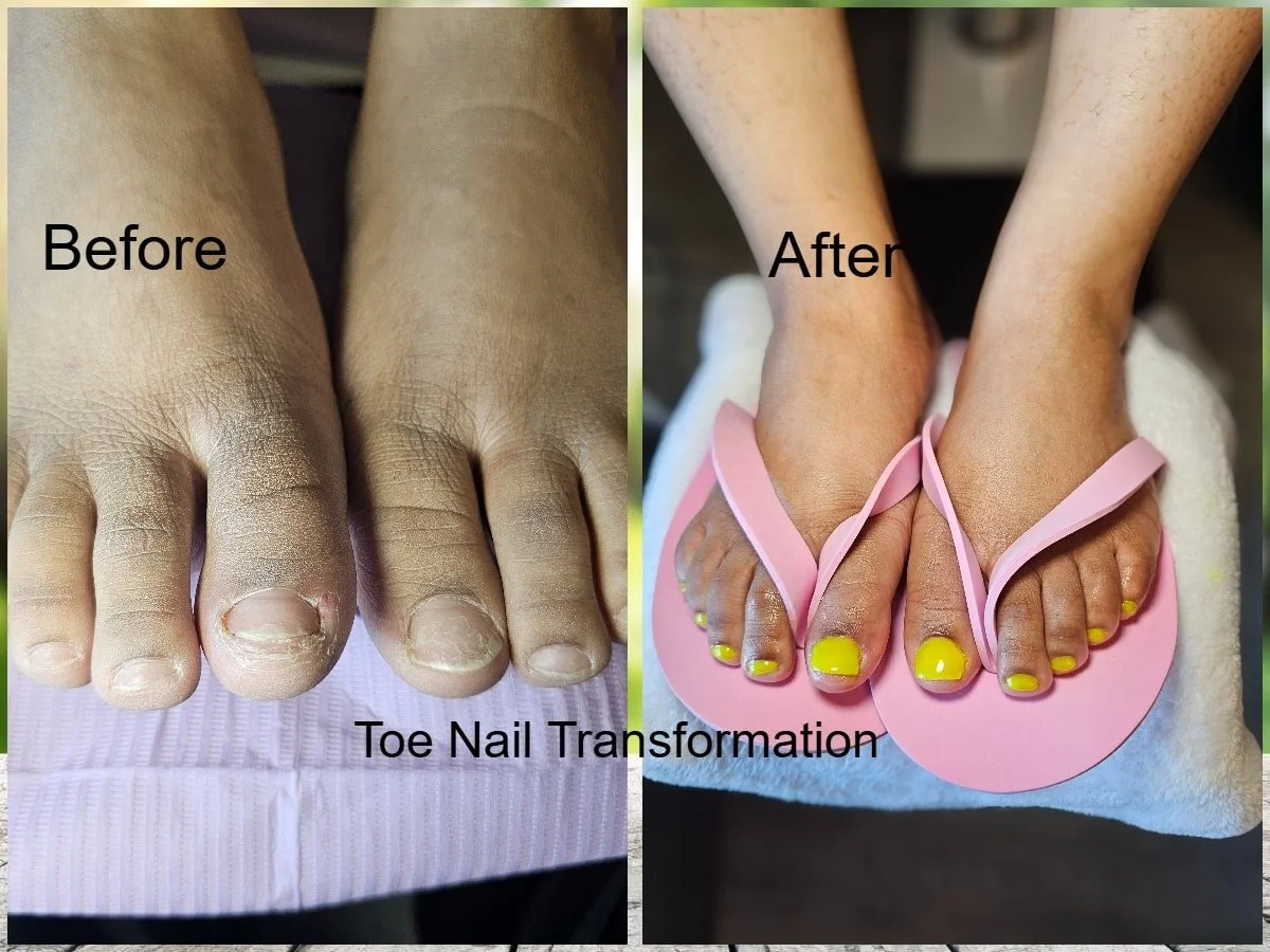Safe Foot & Nail Care for Seniors | Medical Pedicure Services TX ...