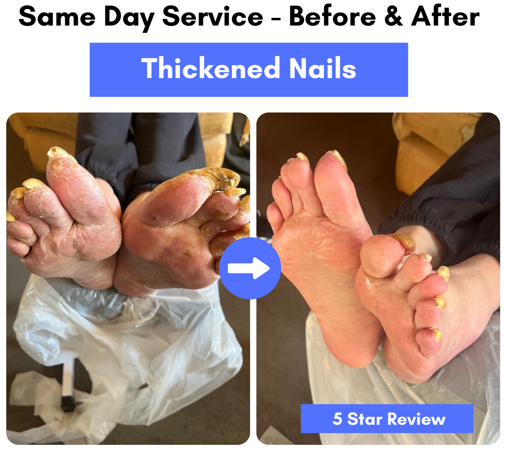 Gina Mobile Foot Care | Foot Health Practitioner for Seniors ...