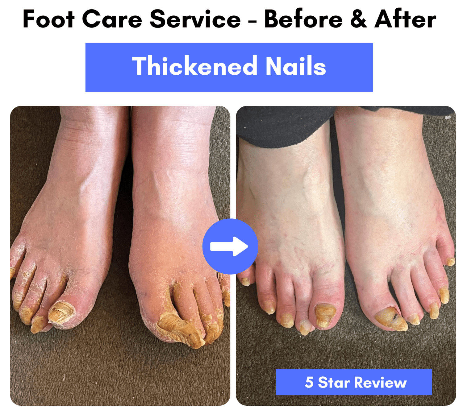 Gina Mobile Foot Care | Foot Health Practitioner for Seniors ...
