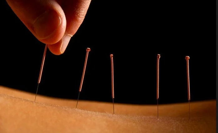Asheville Community Acupuncture