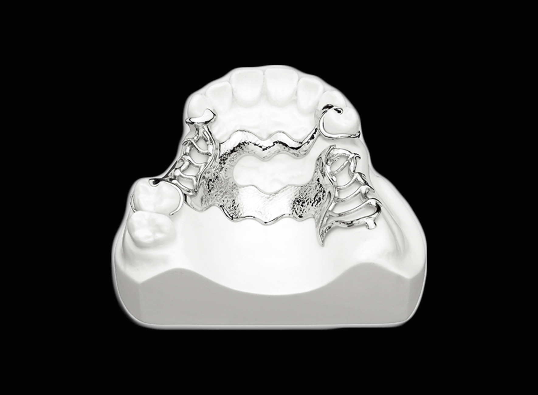 Metal Framework Dentures | Durable Partial Dentures — MAG Dental