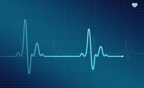 Certified EKG Telemetry Monitor Technician Class – 100% Online & Self ...