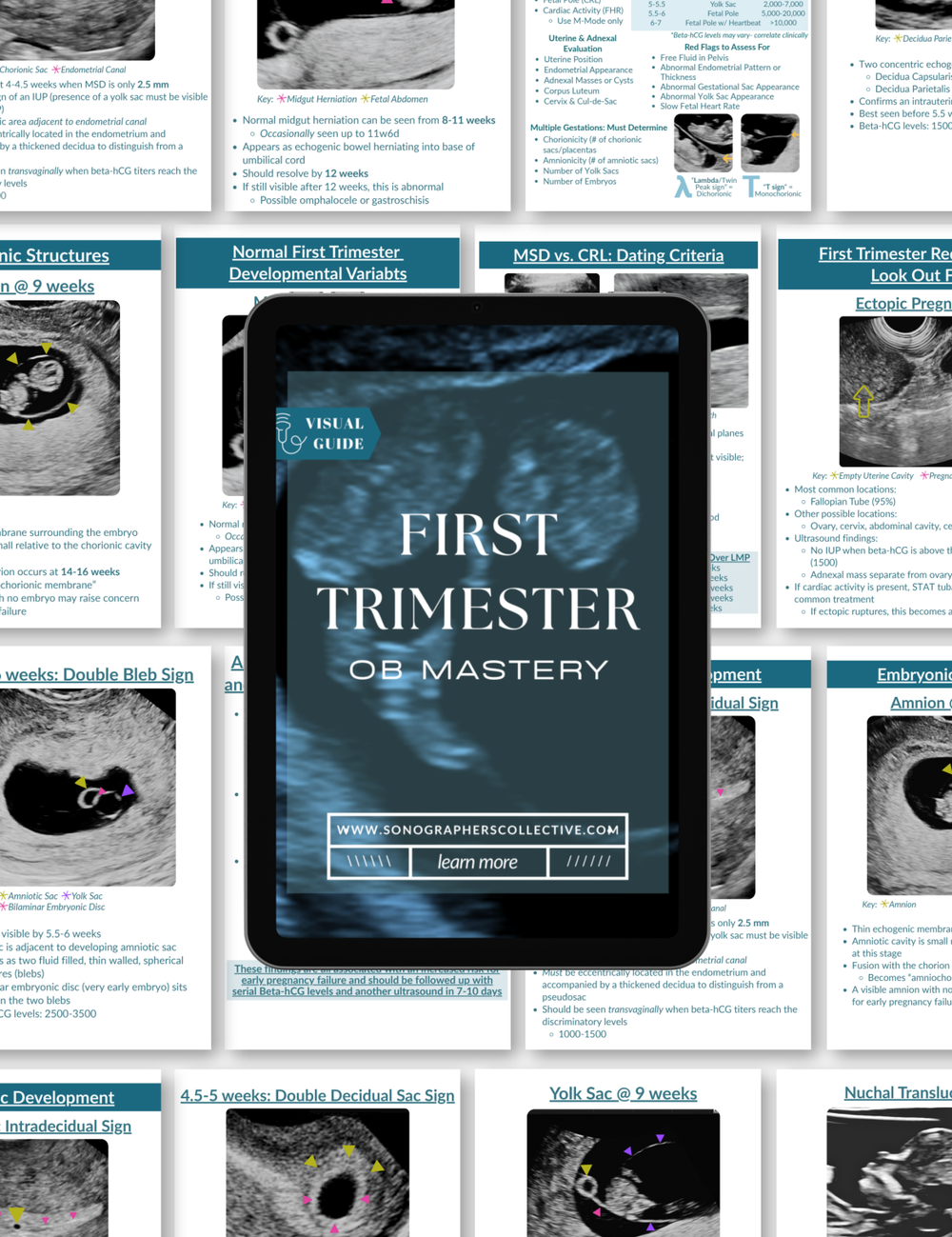 Anatomy Scan: Quick Reference Image Checklist — Sonographers Collective