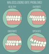 Common Bite Issues You Can Spot at Home — Dr Julia Foo