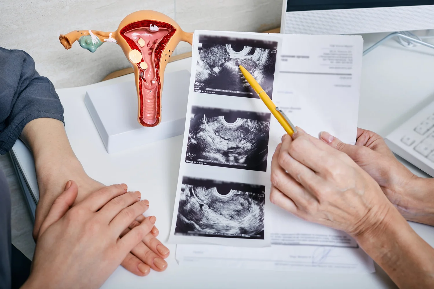 Fertility Specialist & Gynaecologist Sydney | Dr I-Ferne Tan
