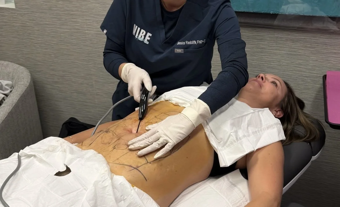 Quantum RF | Non-Surgical Skin Tightening & Contouring — Vibe Aesthetics