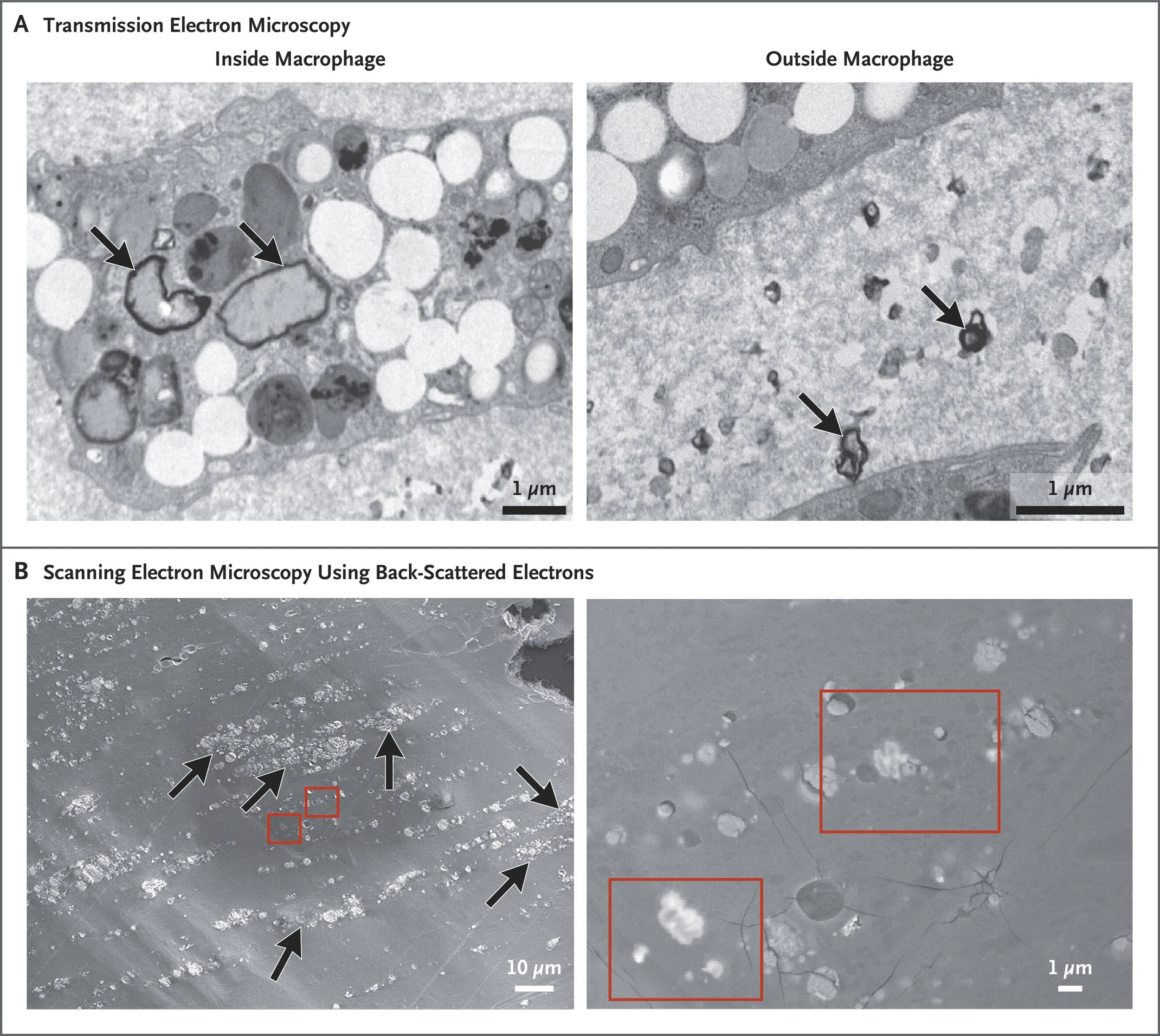Top 5 Scariest Plastic Studies — unseen blog: uncovering plastics ...