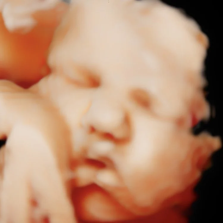 Little Lives Lounge | 5D Baby Ultrasound in Perth | Get Gender ...