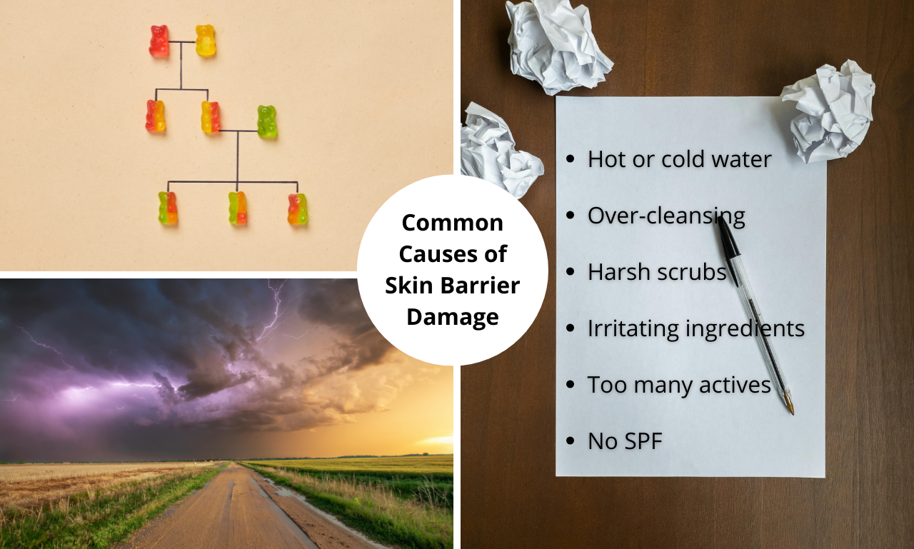 The Skin Barrier Explained: Why It’s Important and How to Keep It ...