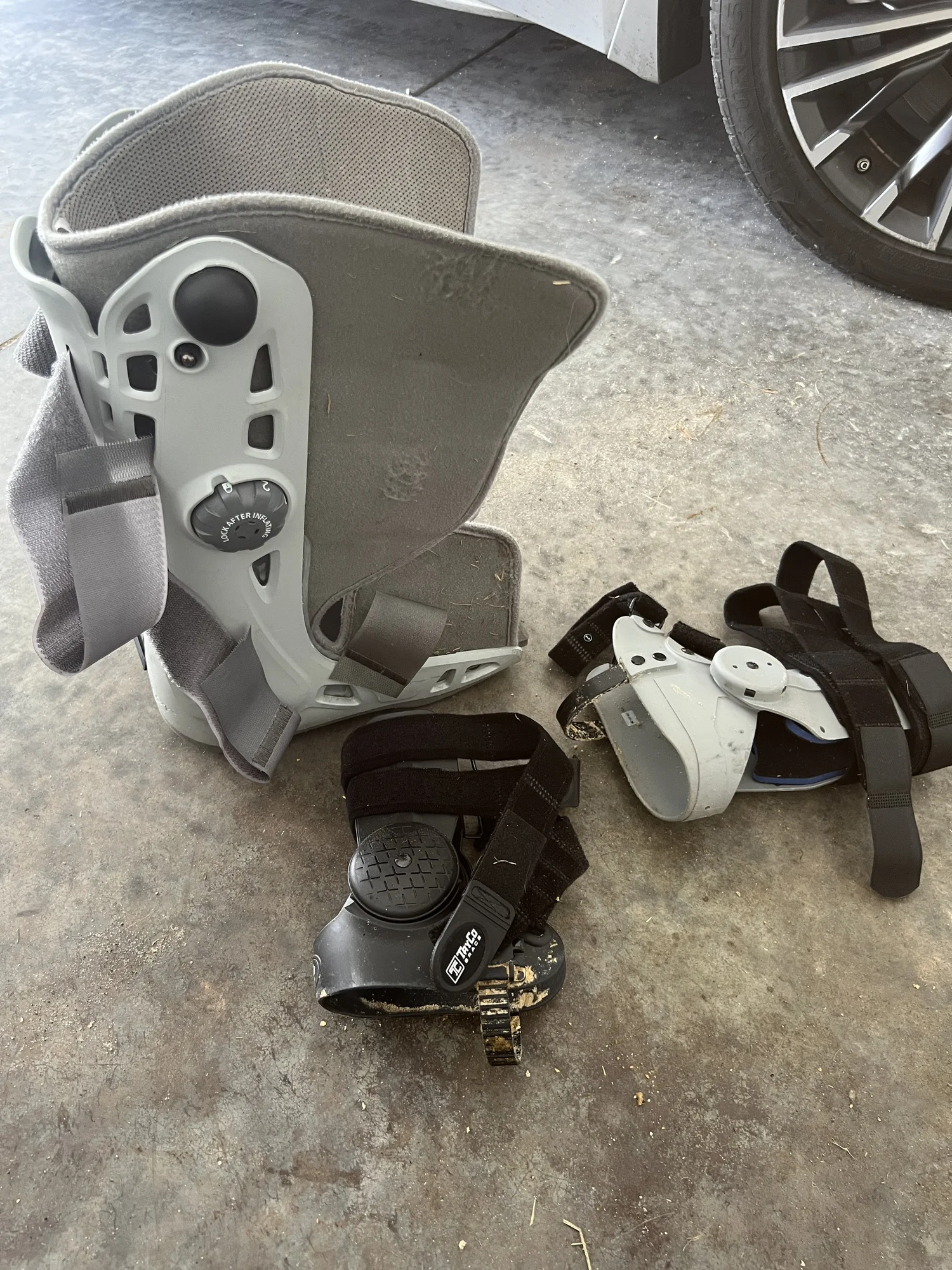 Casts and Braces — Ankle Fracture Recovery Community