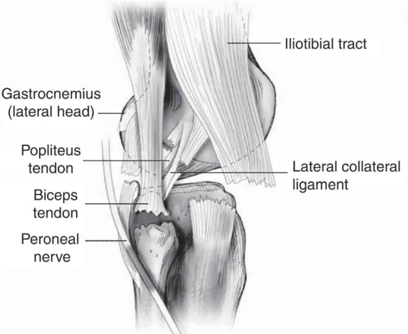 Posterolateral Corner (PLC) Injury — Mr Ian Al'Khafaji | Melbourne ...