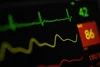 The Stryker Cyber Attack: What Medical and Healthcare Security Leaders ...