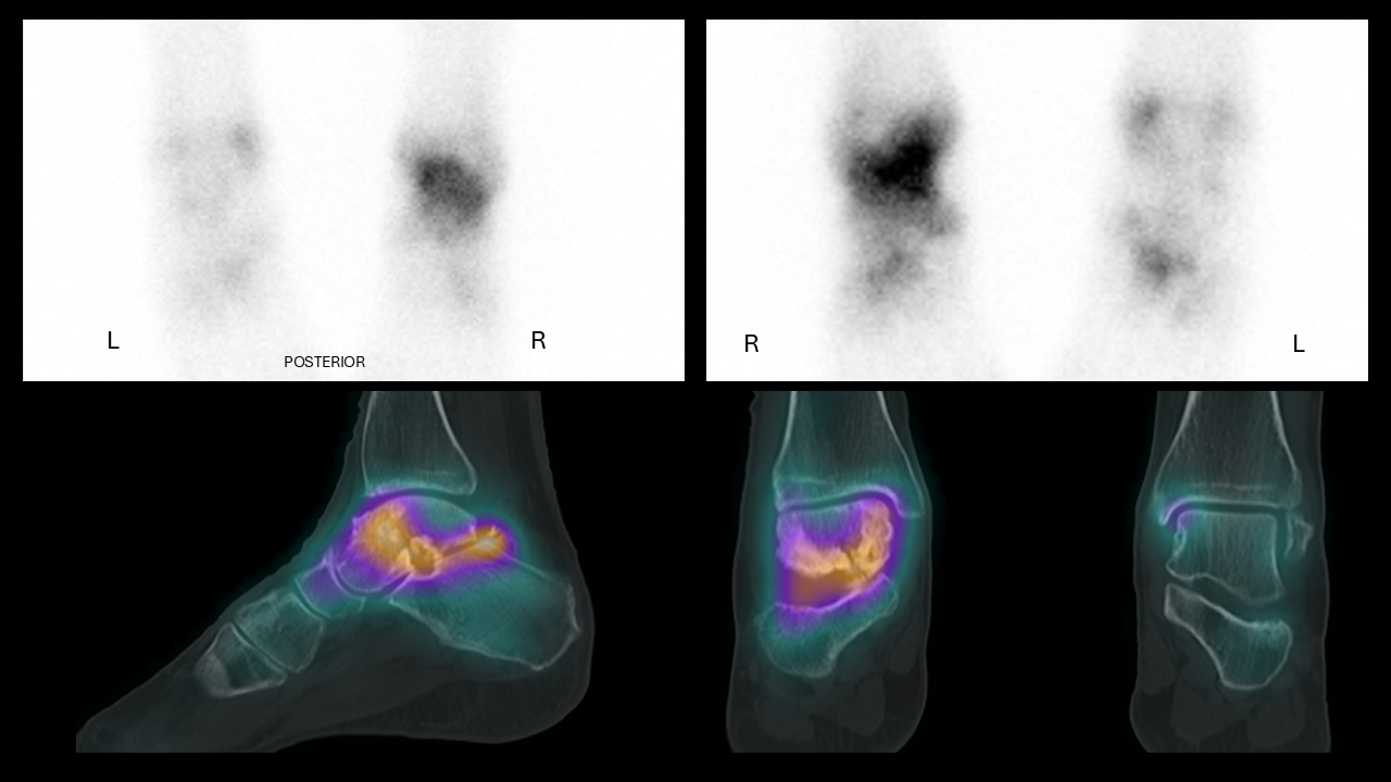 SPECT-CT | Enhance Diagnosis - Book Your Scan — Reform Radiology