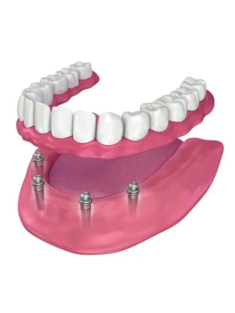 Stockport Implant Centre