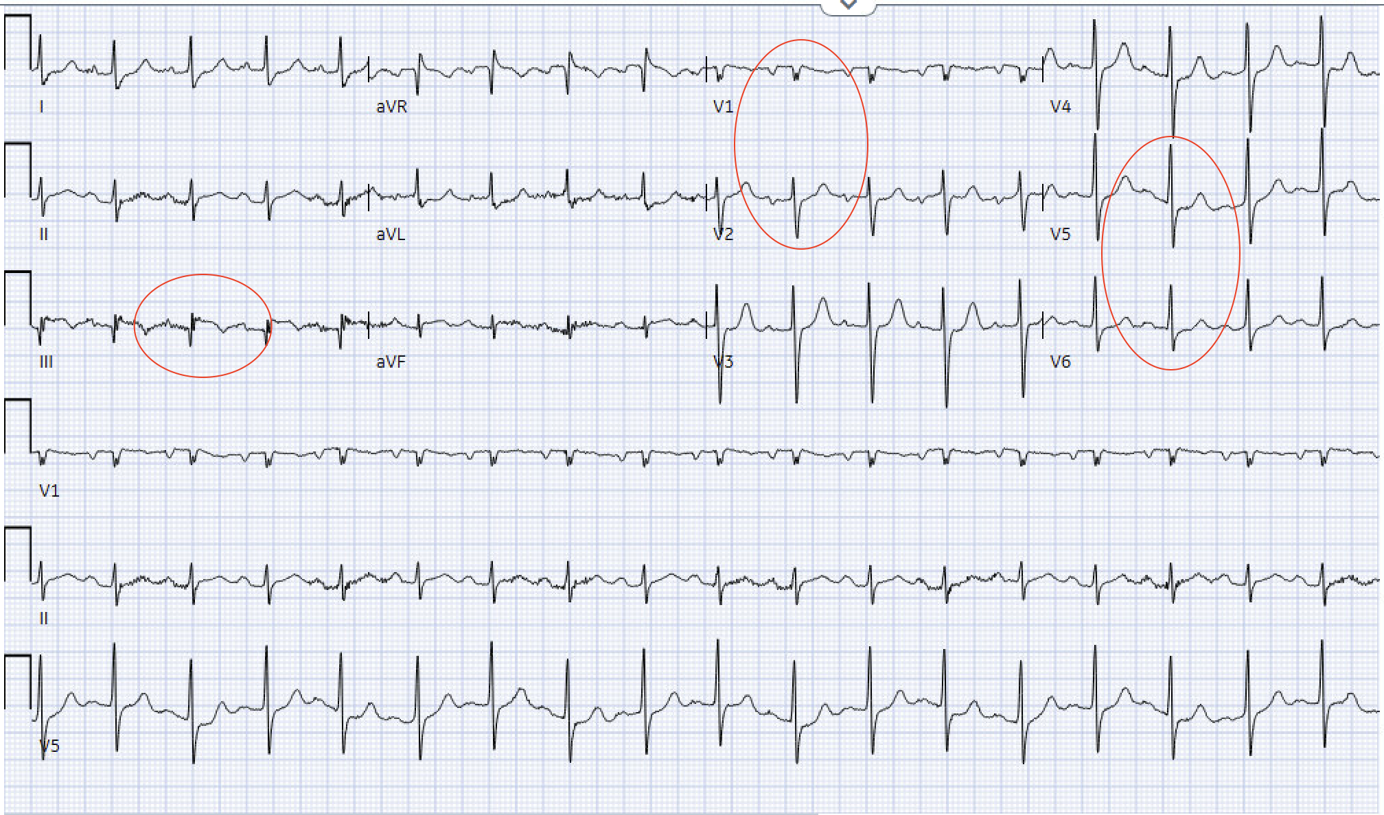 Aslanger Pattern — POST SHIFT PEARLS