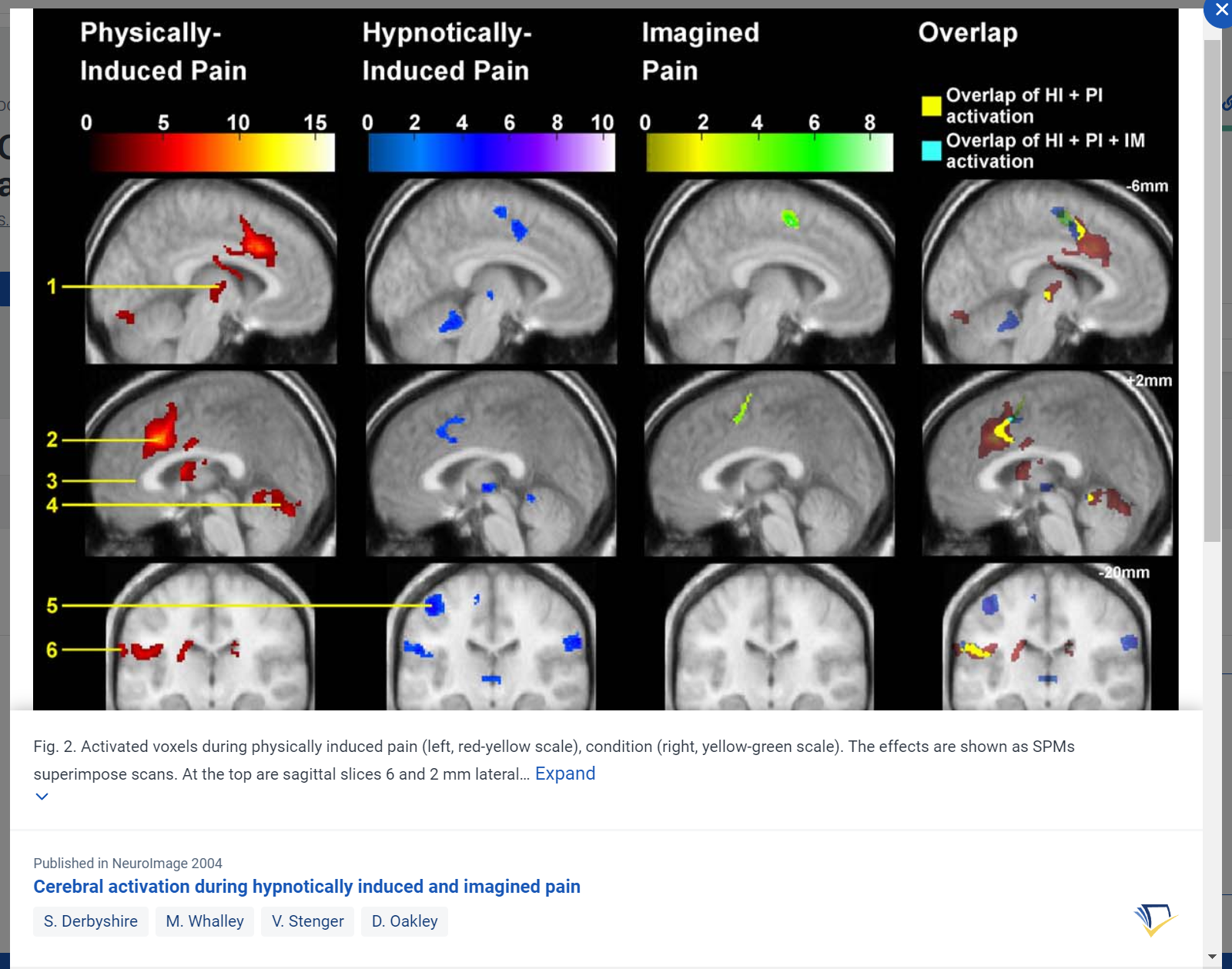 Is Hypnotherapy Legit? Unraveling the Science Behind Brain Changes ...